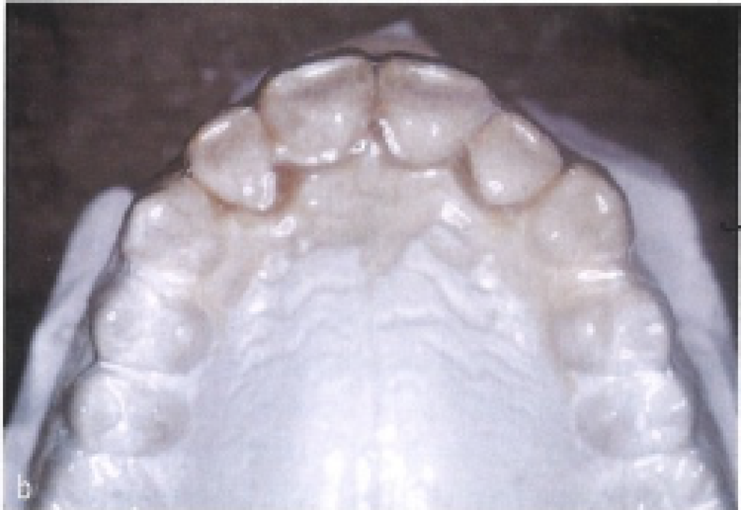 The Contour Appliance Revisited: Evolution, Advancements, and ...