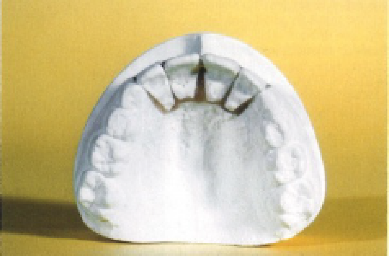 The Contour Appliance Revisited: Evolution, Advancements, and ...