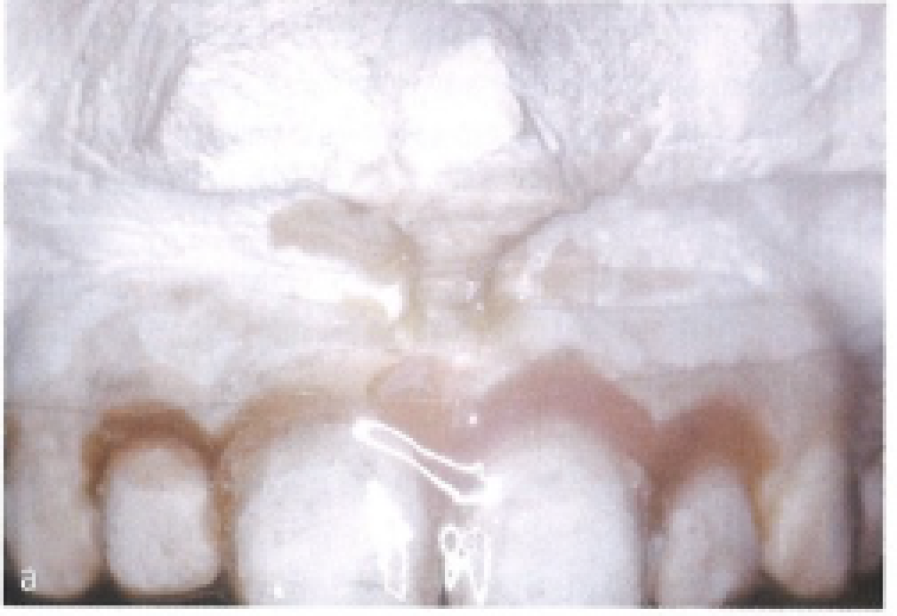 The Contour Appliance Revisited: Evolution, Advancements, and ...