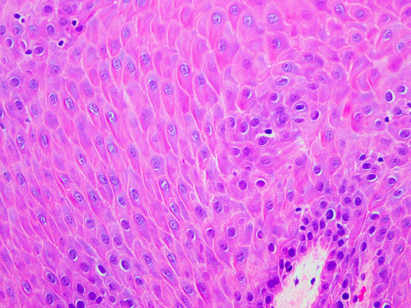 Angela Yoon Seeks Precision Care for Oral Cancer | College of Dental ...