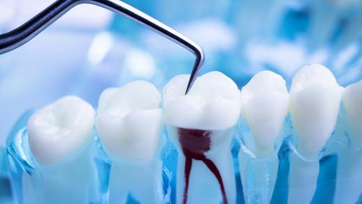 Endodontics Services & Dentists - NYC | College of Dental Medicine