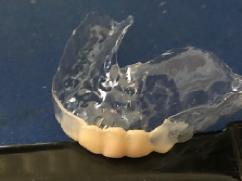 The Contour Appliance Revisited: Evolution, Advancements, and ...